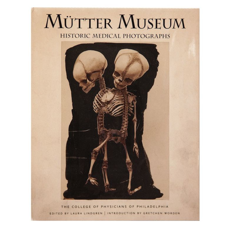 Mutter Museum Fetus