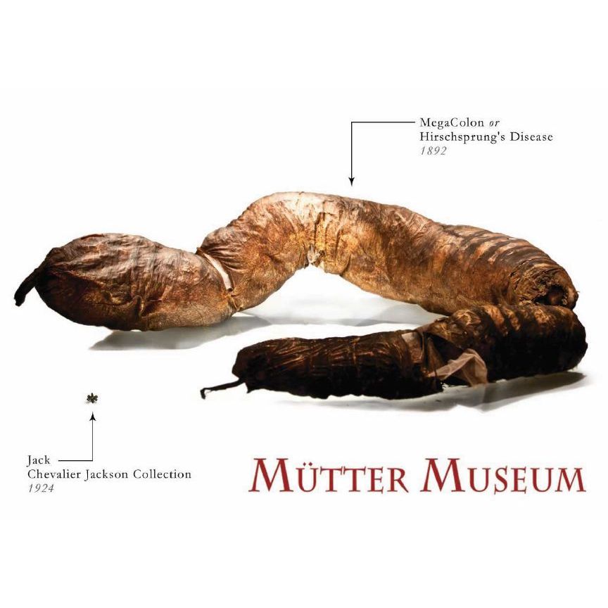 Mutter Museum Colon